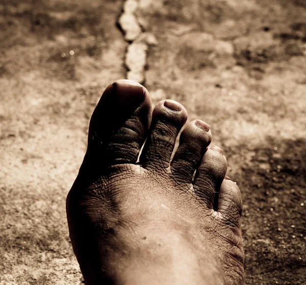 Poor feet Stock Photos, Royalty Free Poor feet Images | Depositphotos