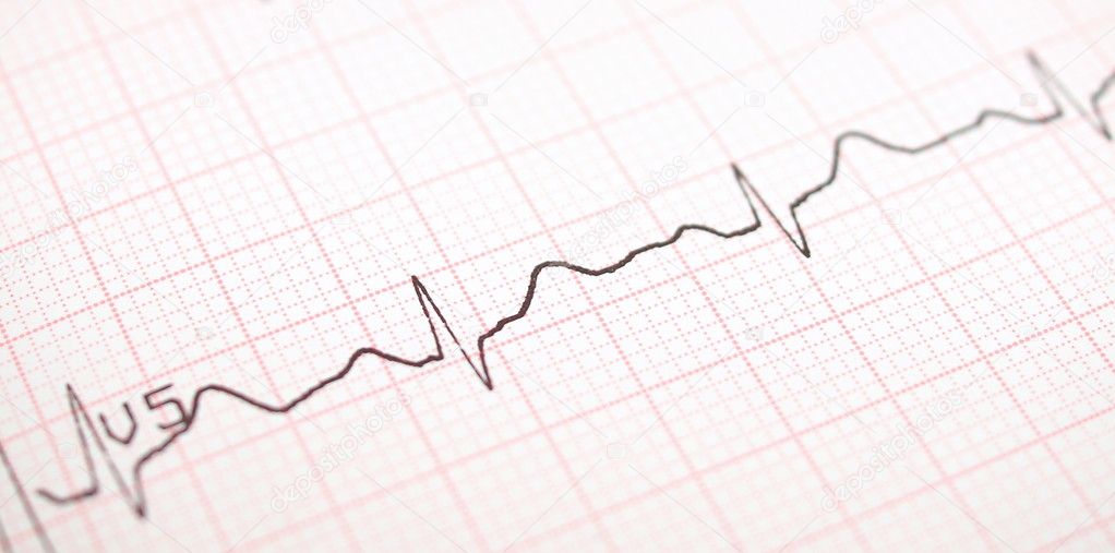 Ecg graph, Electrocardiogram ekg Stock Photo by ©dusan964 5795252