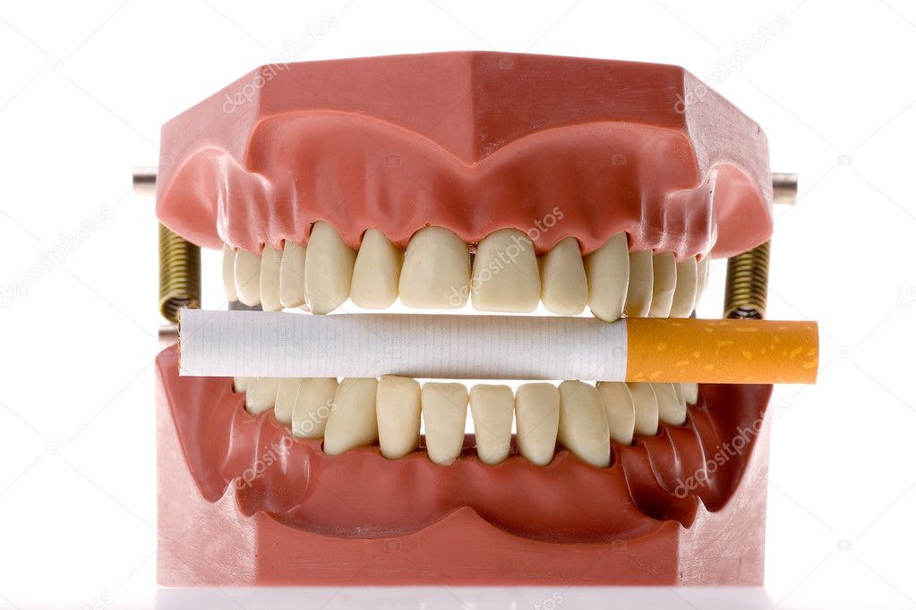 Dental mold biting a cigarette — Stock Photo © ChepeNicoli #6086084